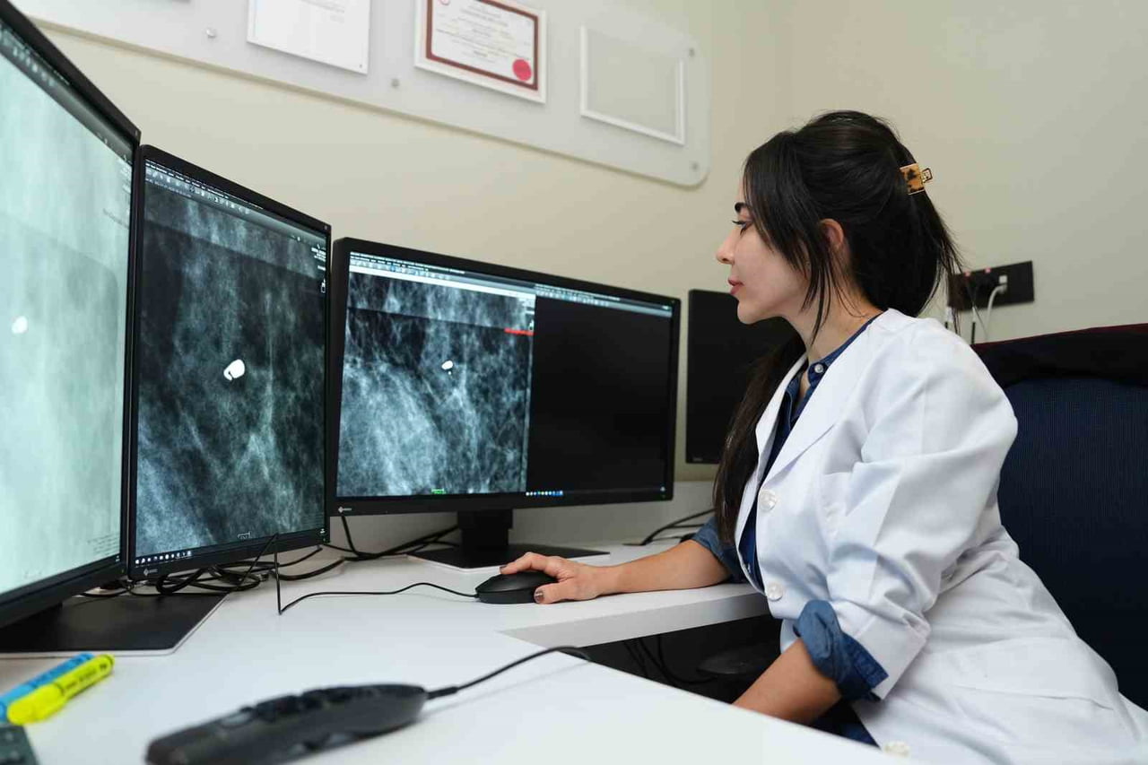 Mamografideki küçük kireçlenmeler erken meme kanseri habercisi olabilir
